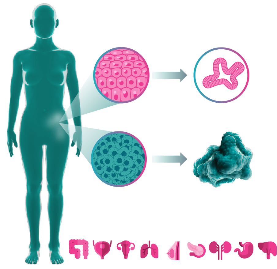 Antibody-Drug-Conjugate Solutions | ADC | Organoid Technology - HUB ...